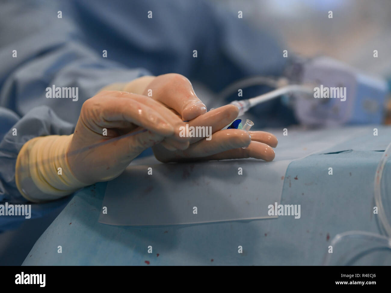 Heart valve repair hi-res stock photography and images - Alamy