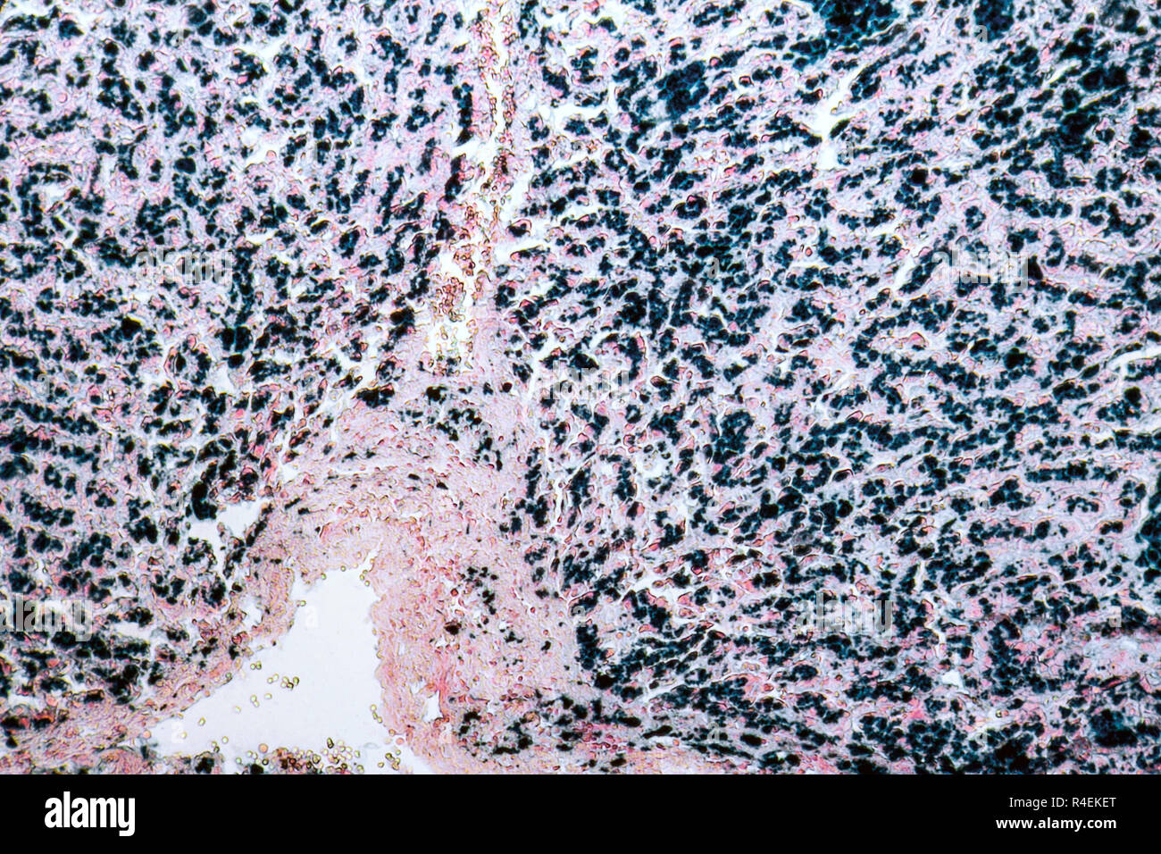 human liver micrography Stock Photo - Alamy