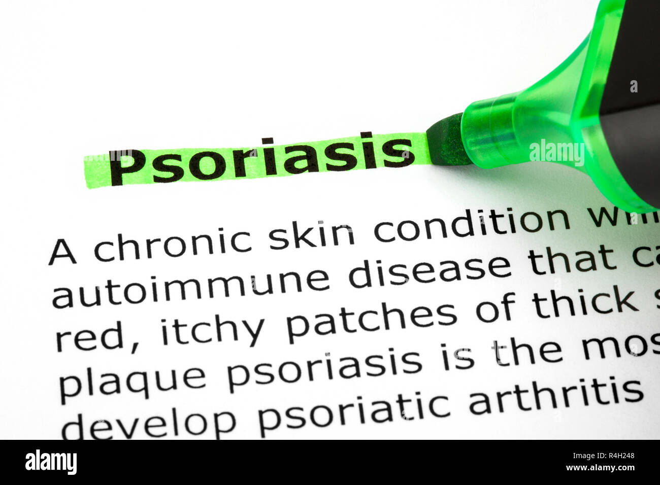 Plaque psoriasis hi-res stock photography and images - Alamy