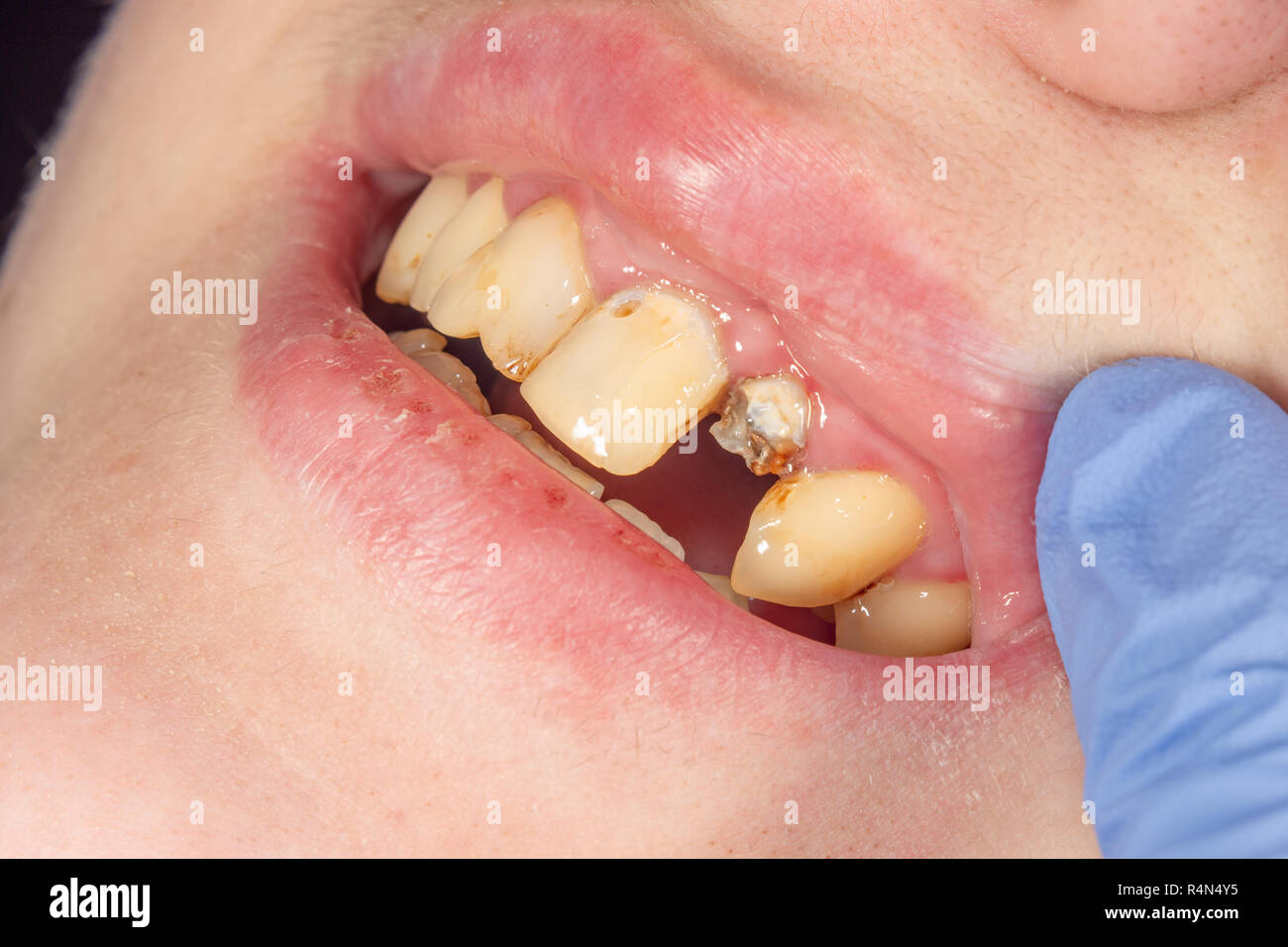 Remove face icon hi-res stock photography and images - Alamy