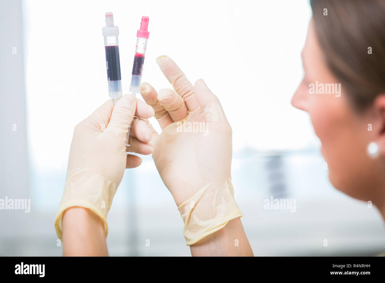Doctor checking blood samples Stock Photo - Alamy