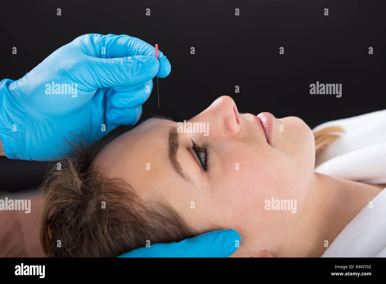 Hand Putting Acupuncture Needle On Woman's Forehead Stock Photo - Alamy
