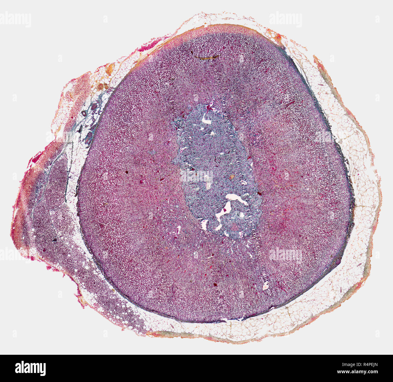 adrenal gland cross section Stock Photo - Alamy