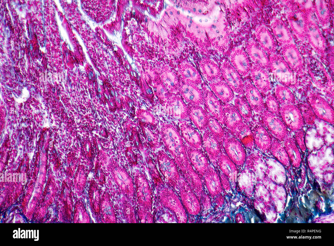 duodenum cross section Stock Photo - Alamy