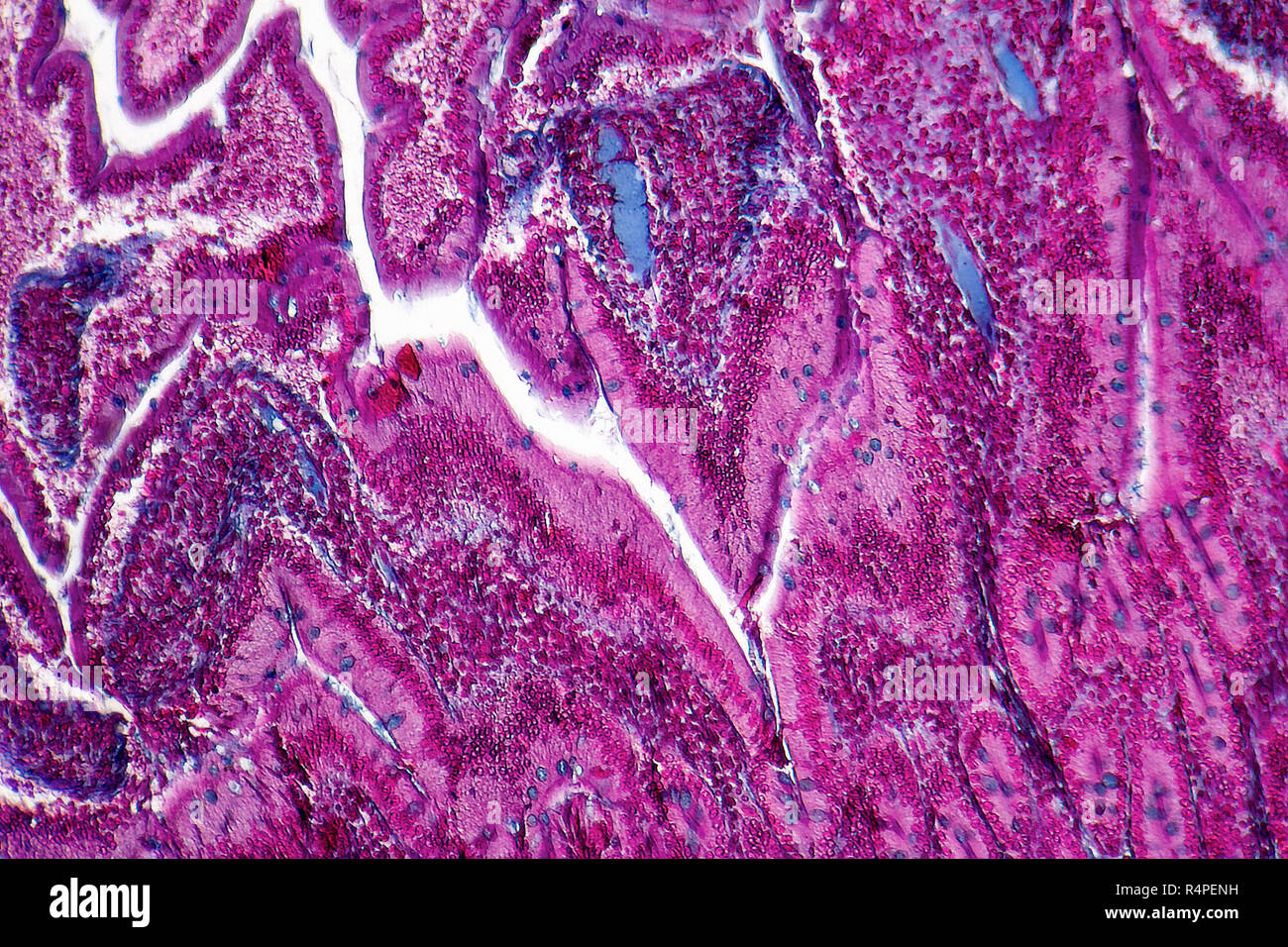 duodenum cross section Stock Photo - Alamy