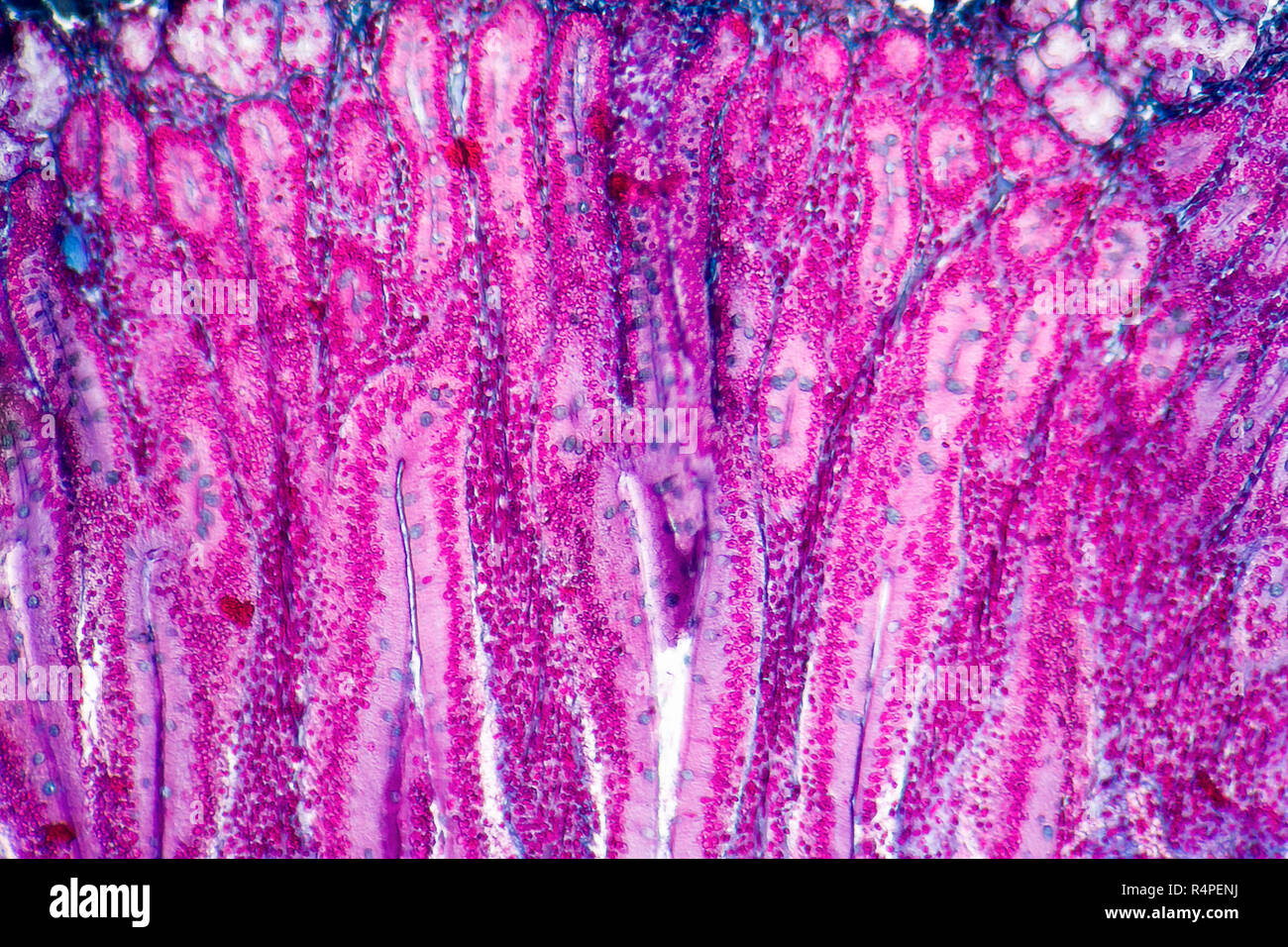 Cross section of small intestine hi-res stock photography and images ...