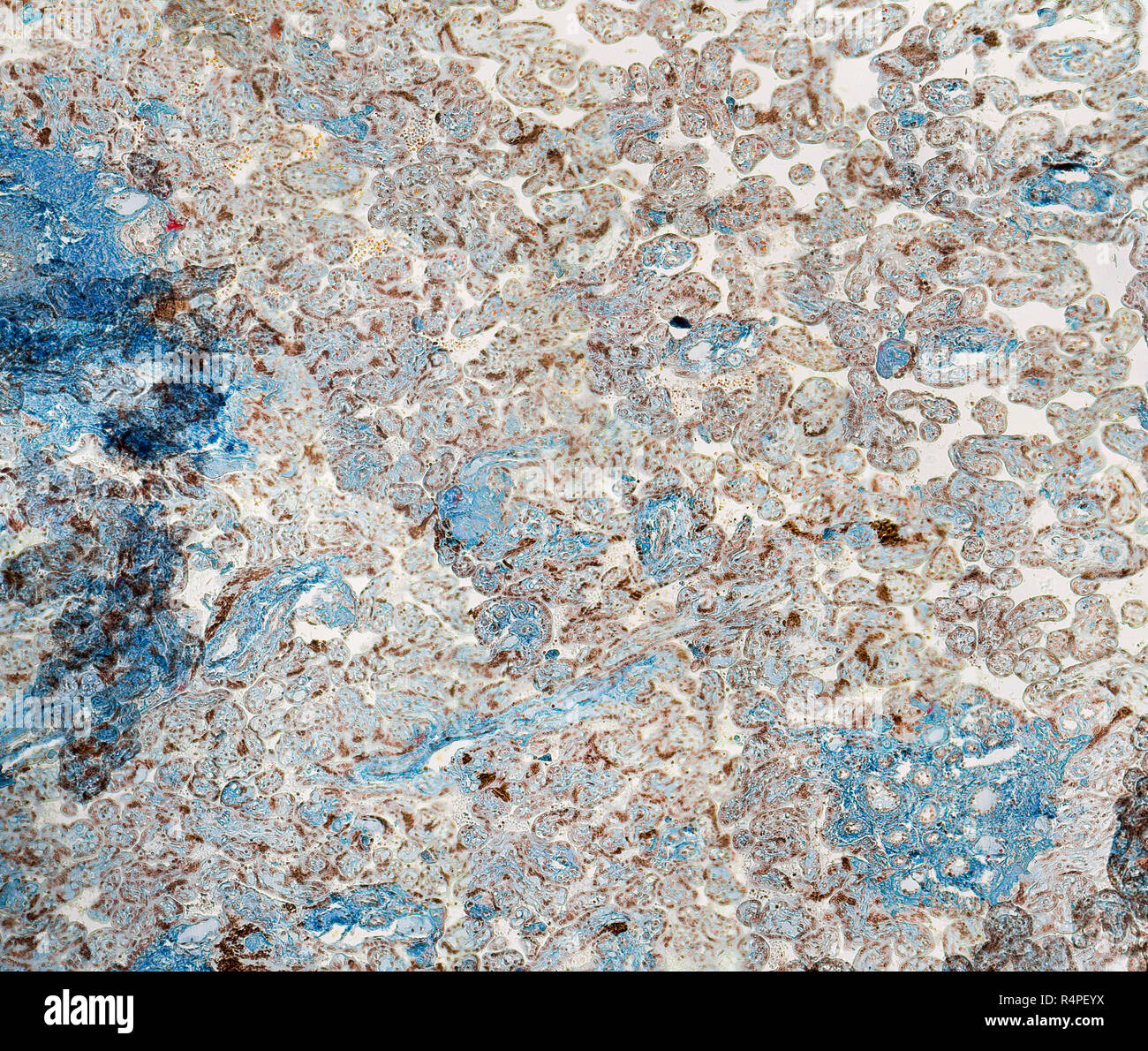 Human figure cross section hi-res stock photography and images - Alamy