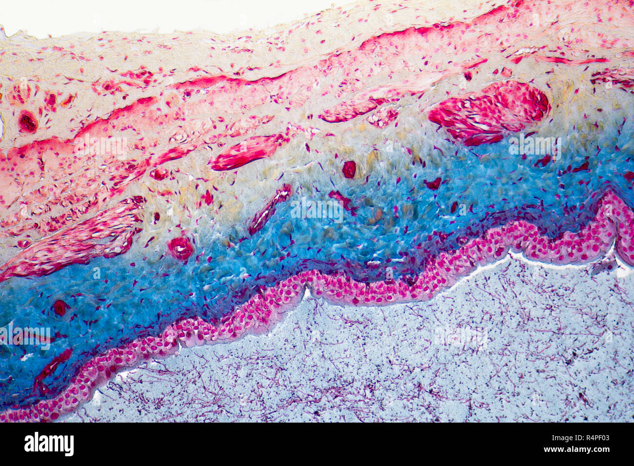 Urinary bladder hi-res stock photography and images - Alamy