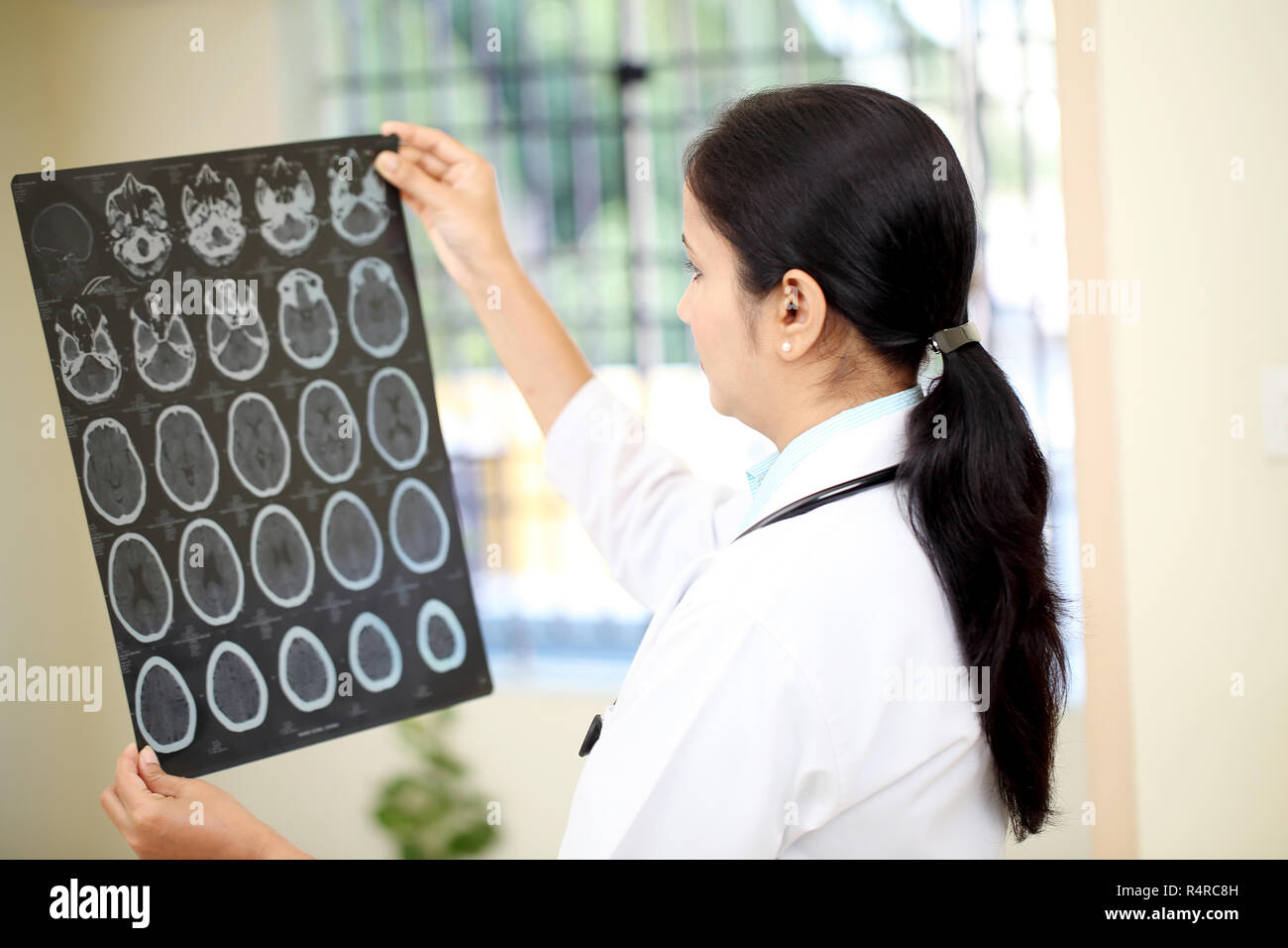Female doctor examining a brain computerized tomography scan Stock ...