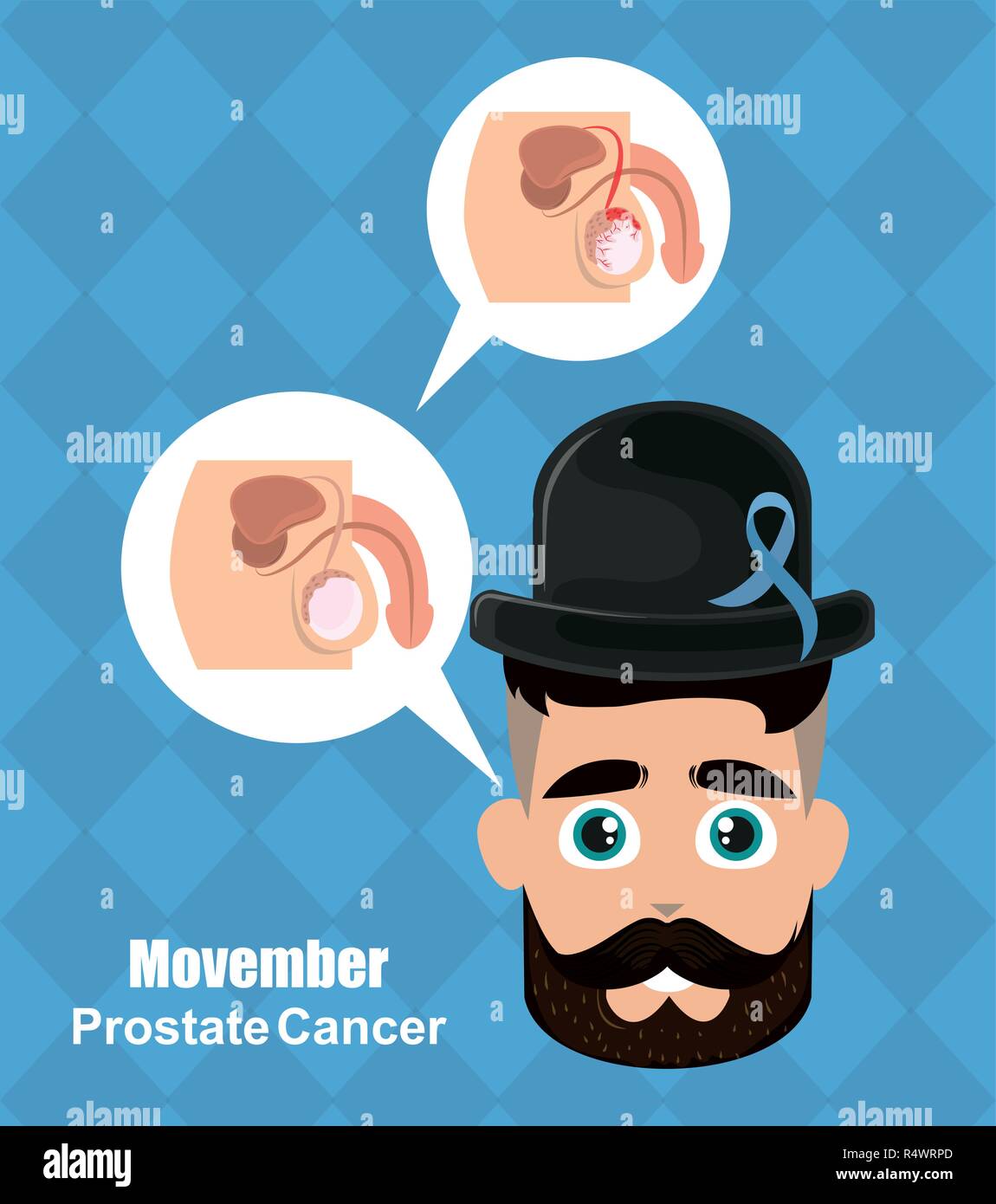 Prostate carcinoma Stock Vector Images - Alamy