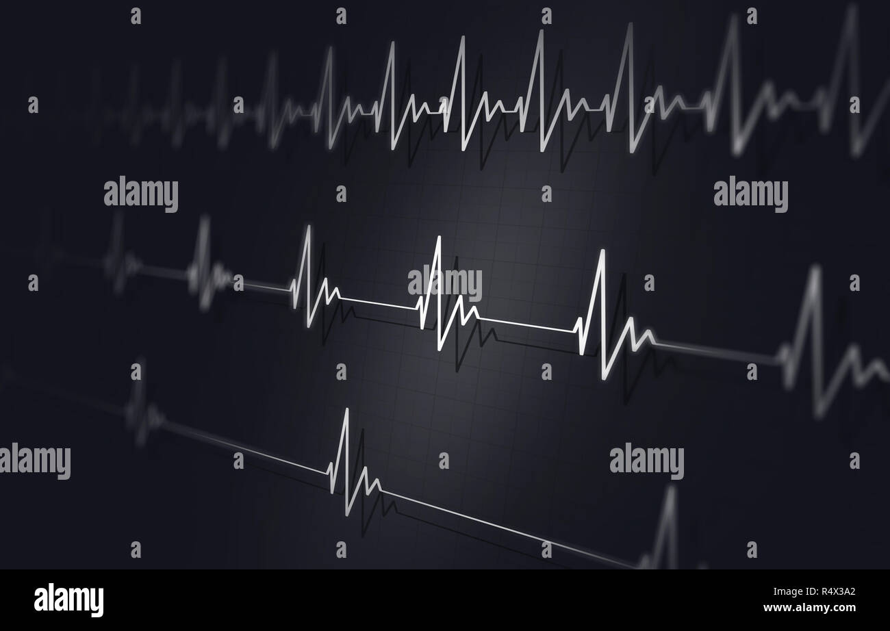 medical background of heart pulsating fast normal and slow Stock Photo ...