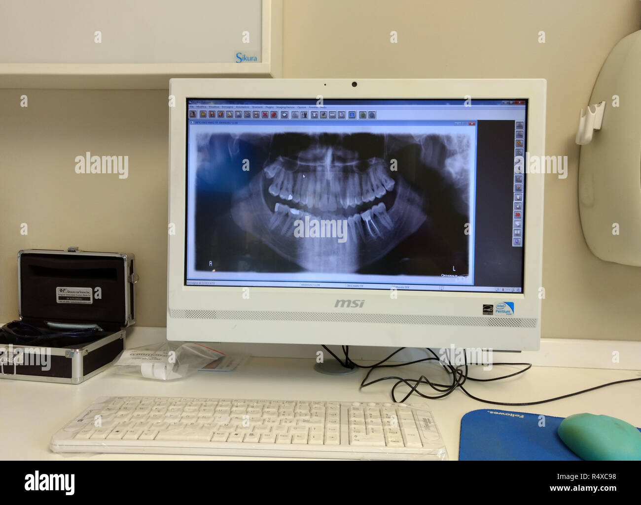 A computer monitor with an x-ray radiograph of the mouth and the upper ...