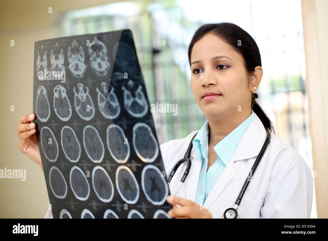 Female doctor examining a brain computerized tomography scan Stock ...