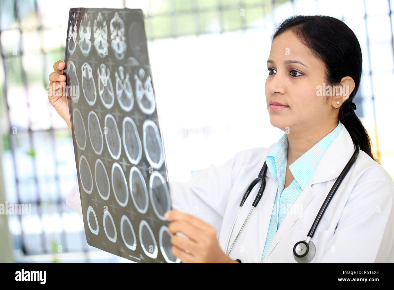 Female doctor examining a brain computerized tomography scan Stock ...