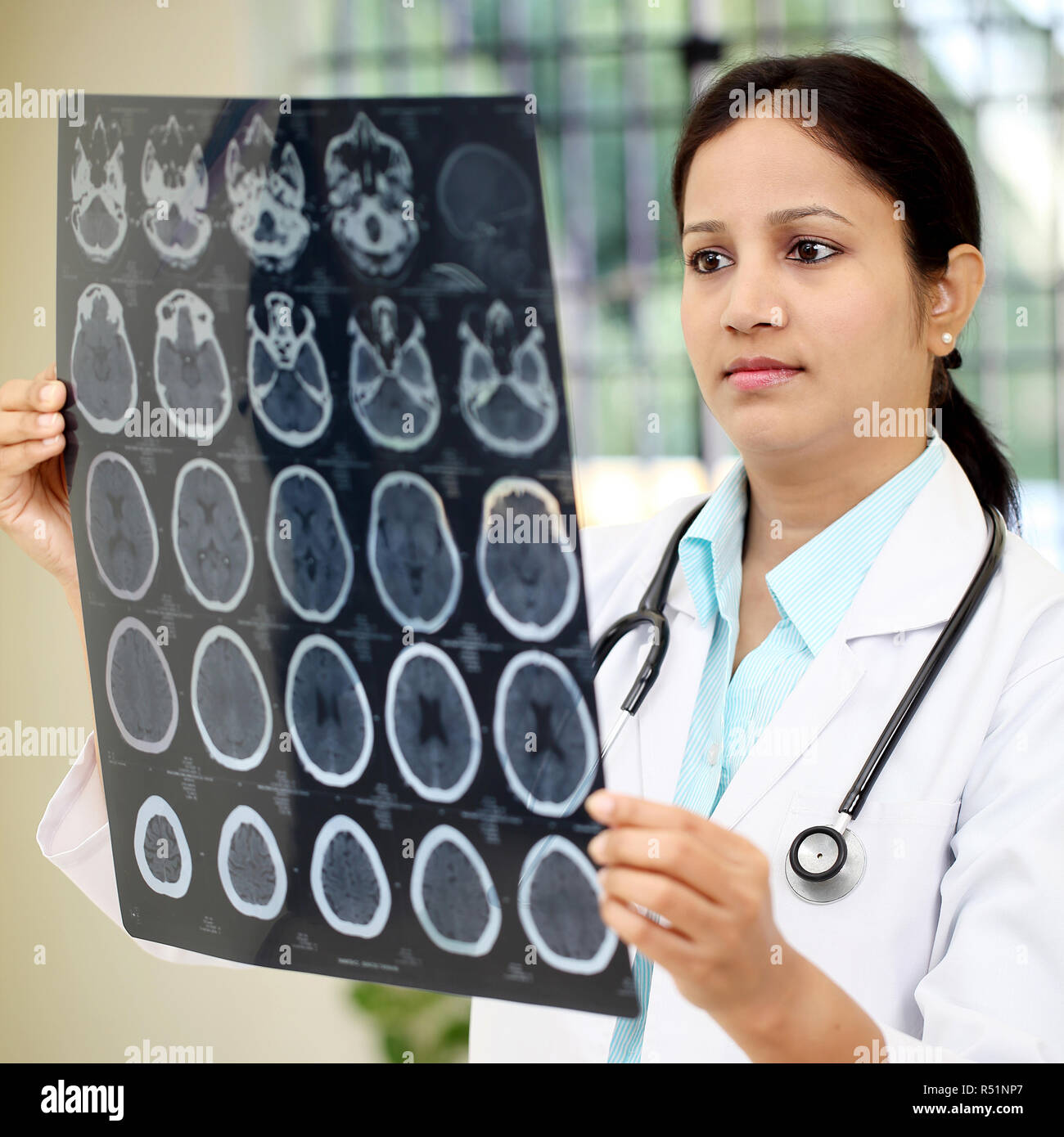 Female doctor examining a brain computerized tomography scan Stock ...
