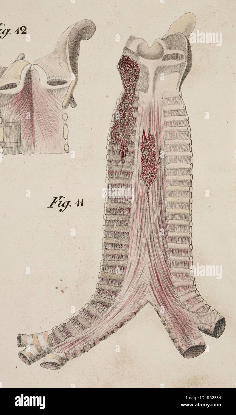 Anatomical drawing. Larynx. Voicebox. Windpipe. Trachea. Planches ...