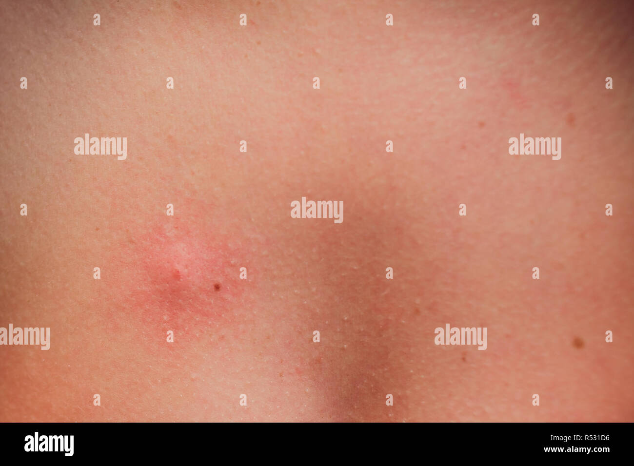 Skin close up hi-res stock photography and images - Alamy