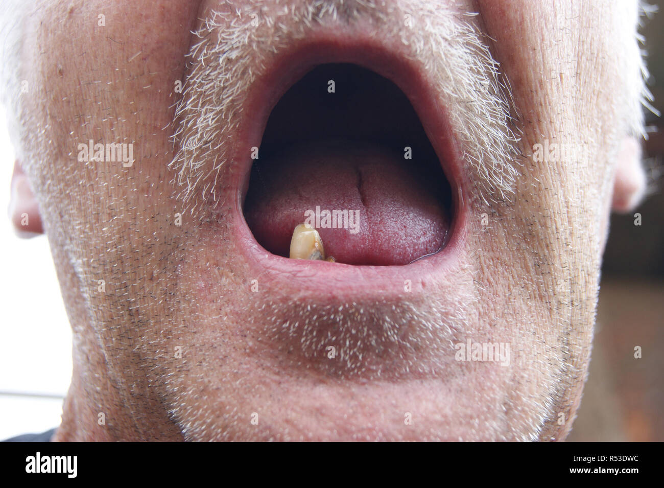 Without teeth hi-res stock photography and images - Alamy