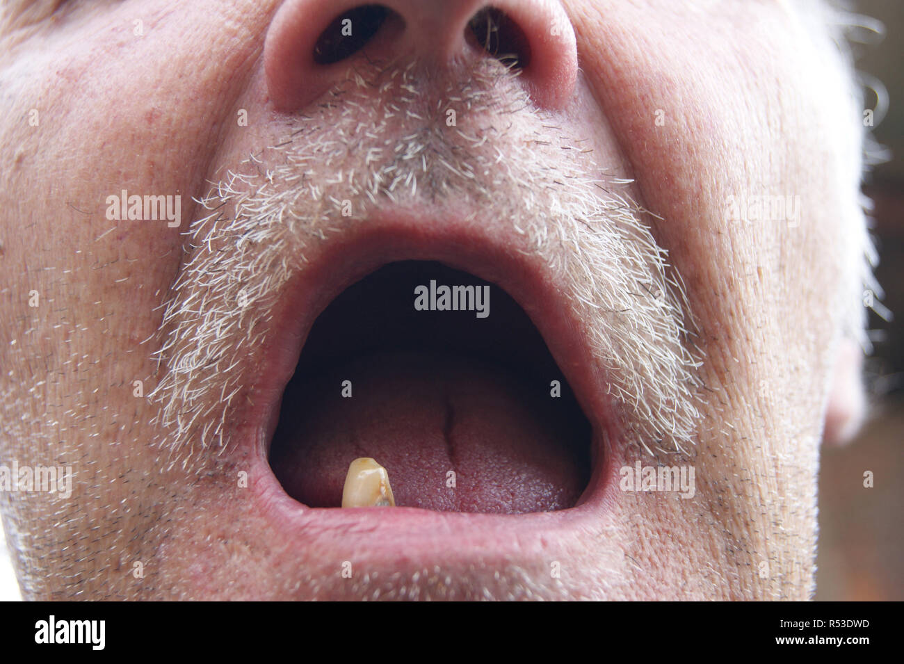 Unshaven man at dentist hi-res stock photography and images - Alamy