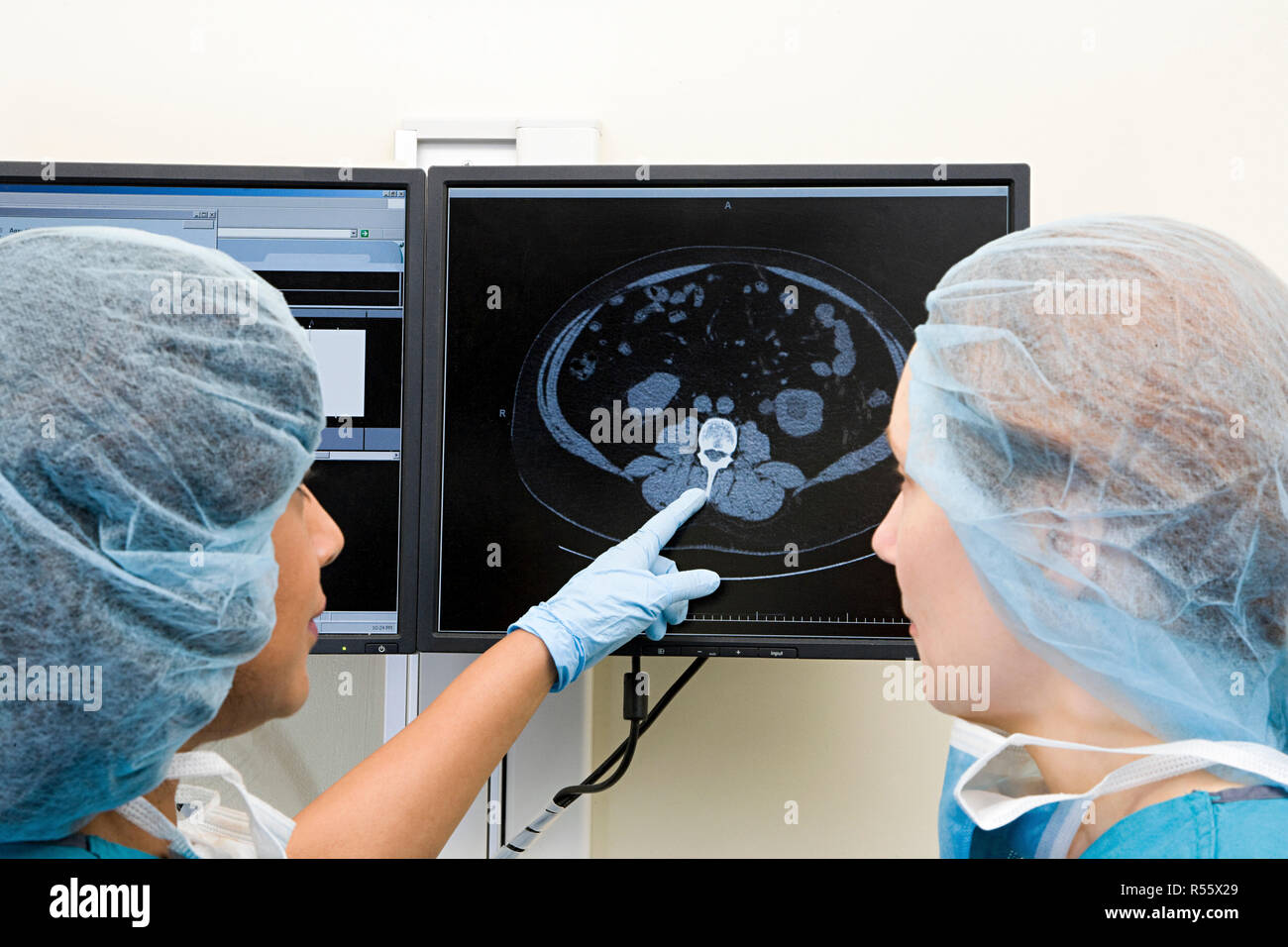 Surgeons looking at scan Stock Photo - Alamy