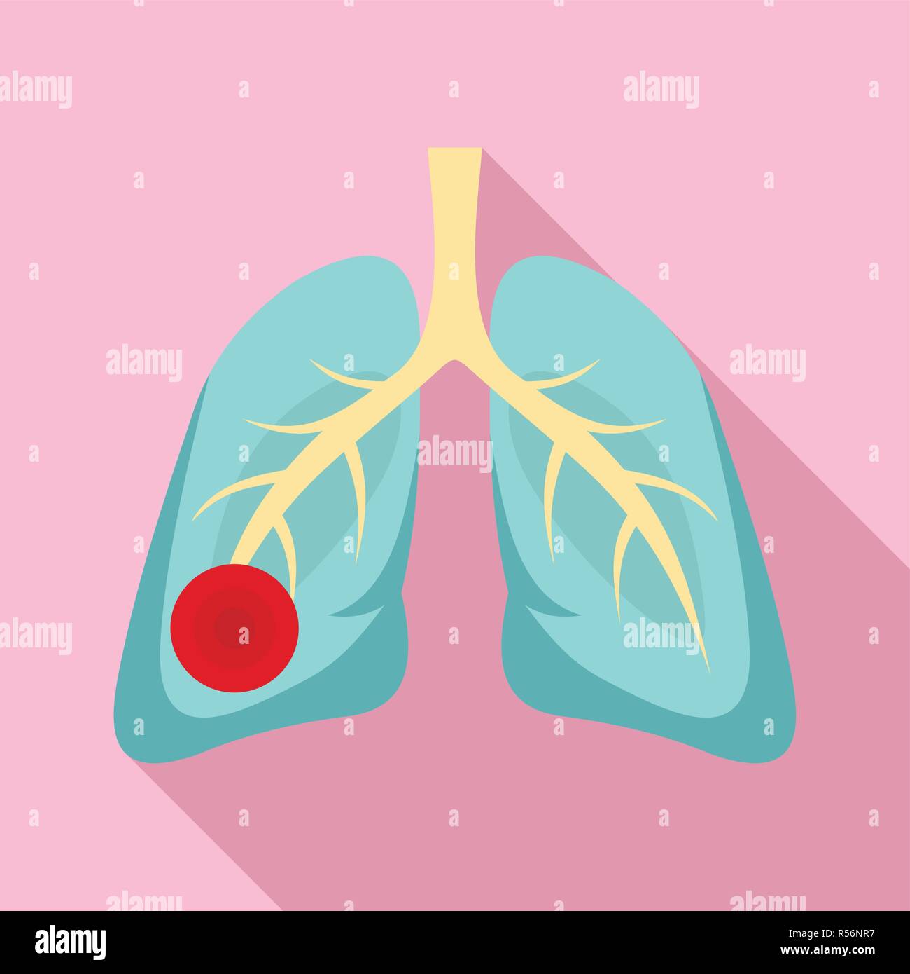 Pneumonia lungs icon. Flat illustration of pneumonia lungs vector icon ...
