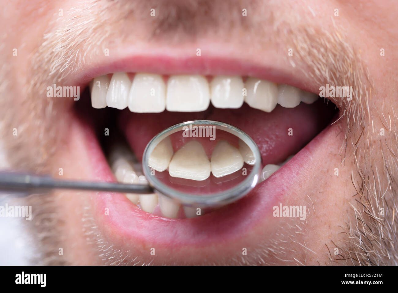 Dental man hi-res stock photography and images - Alamy