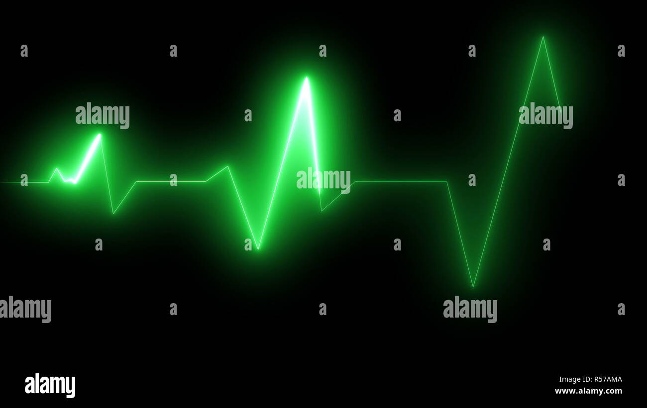 Flatline heart monitor hi-res stock photography and images - Alamy