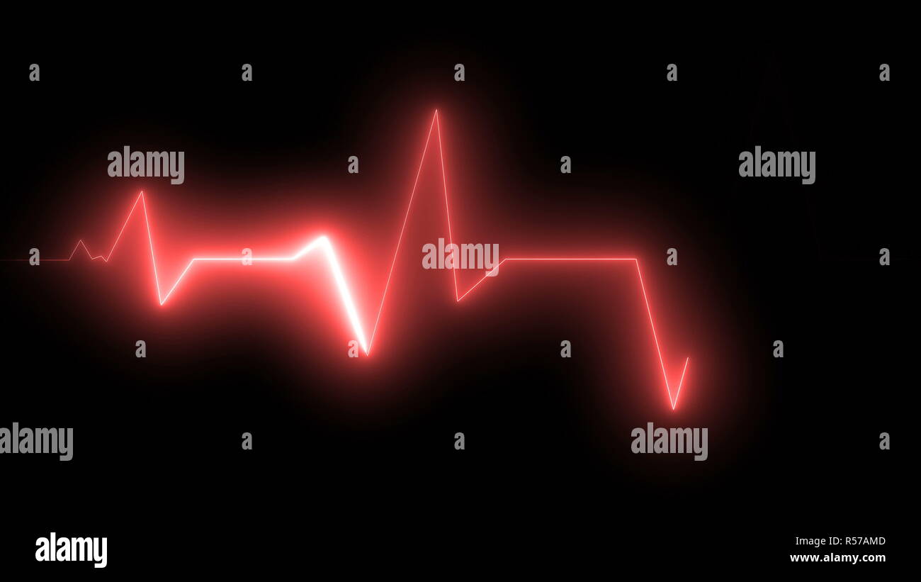 Flatline monitor hi-res stock photography and images - Alamy