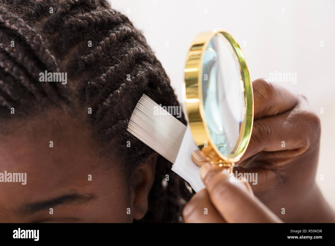 Dermatologist Looking At Patient's Hair Stock Photo - Alamy