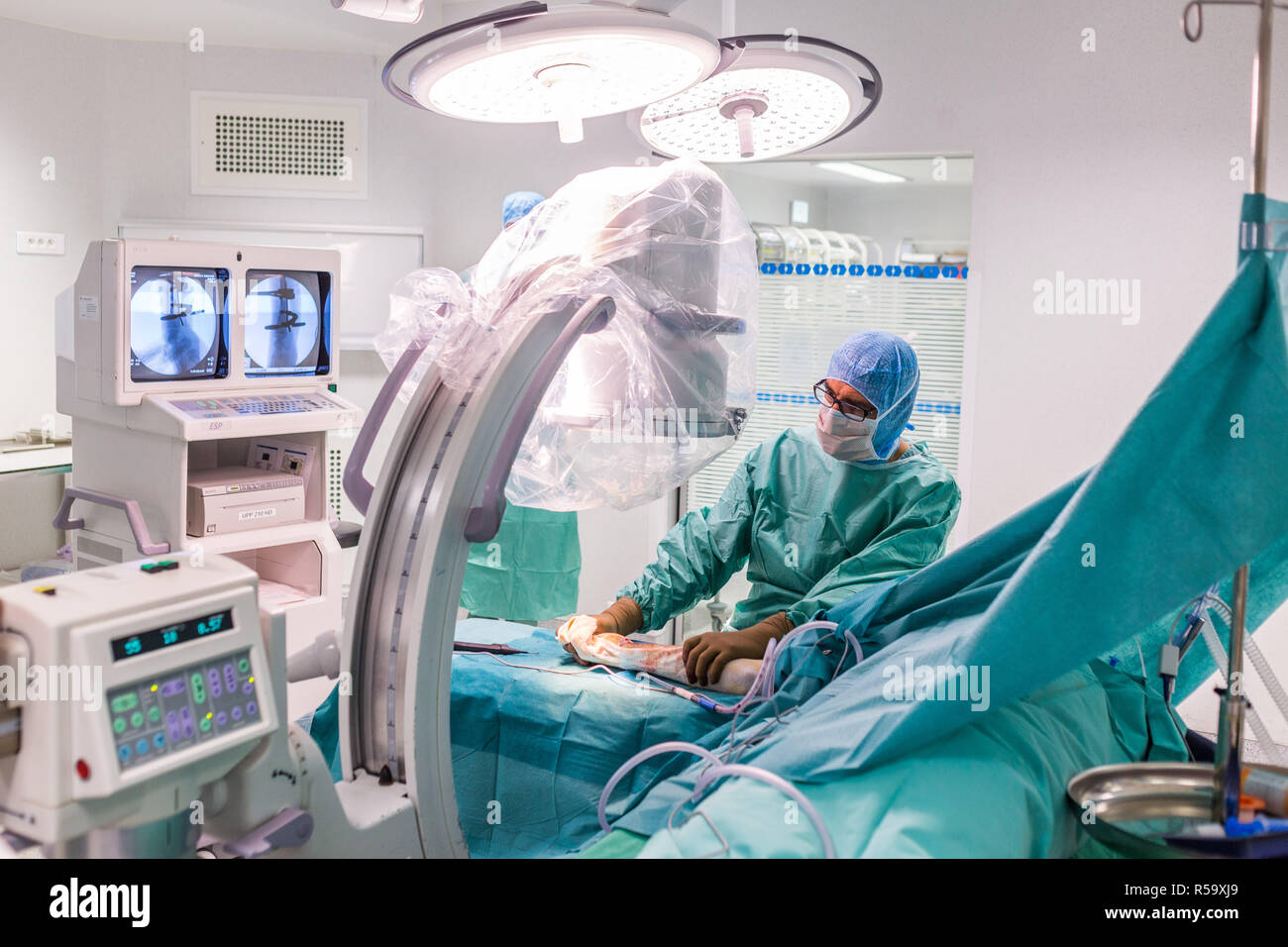 Open reduction internal fixation hi-res stock photography and images ...