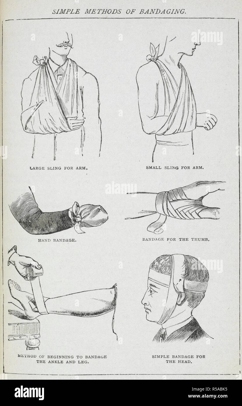 Simple Methods of Bandaging. The book of household management ...