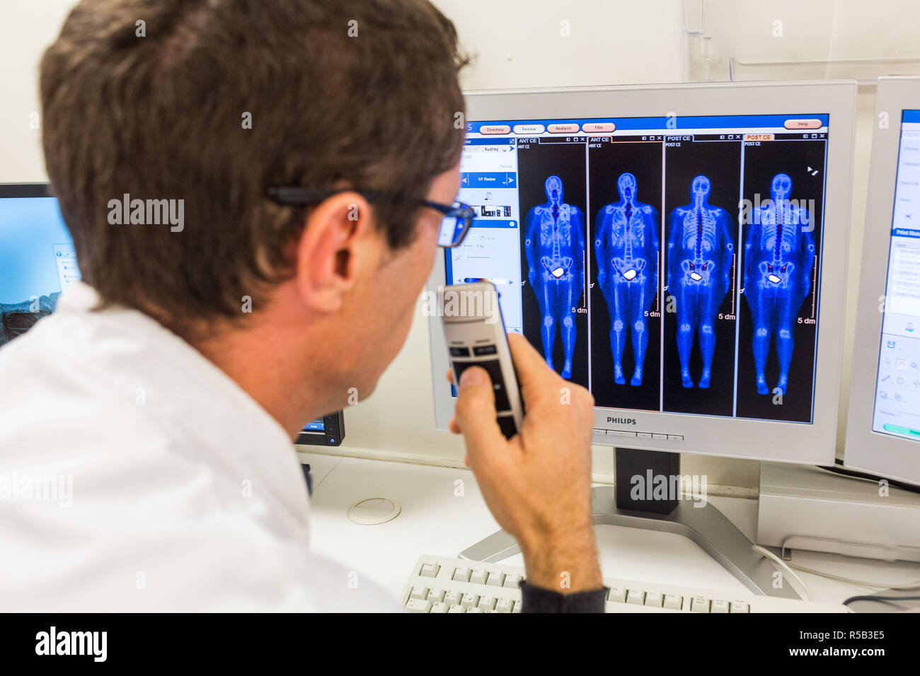 Gamma Scan Bone High Resolution Stock Photography and Images - Alamy