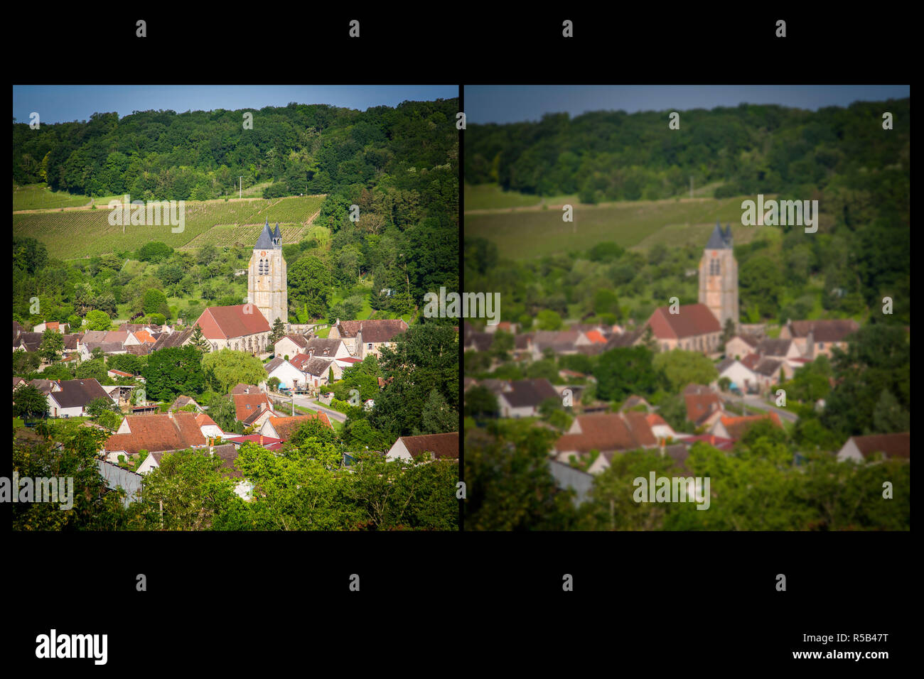 Cataract of right eye hi-res stock photography and images - Alamy