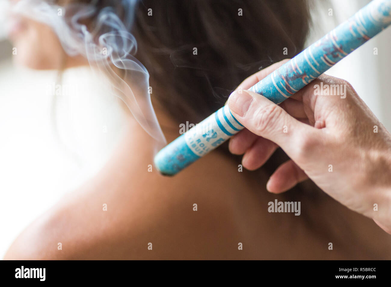 Chinese acupuncture and moxibustion hi-res stock photography and images ...
