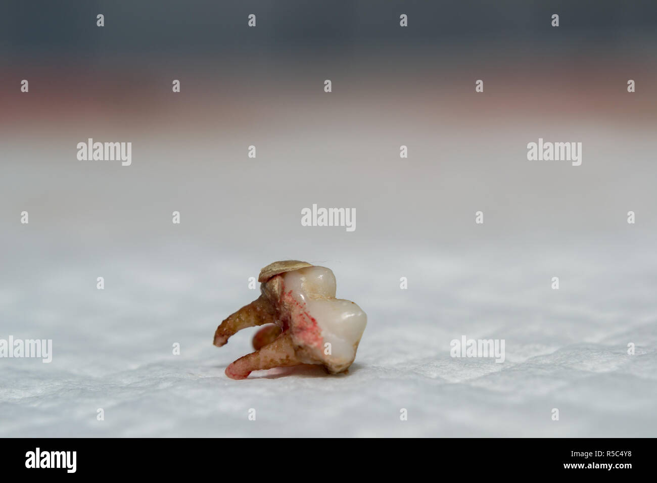 Dog tooth extracted. Pulp infection. Tartar Stock Photo - Alamy