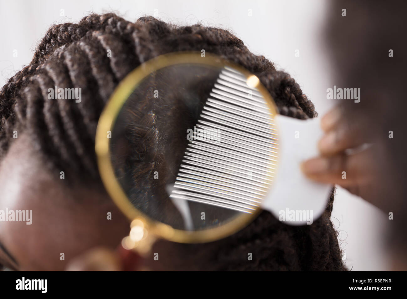 Dermatologist Looking At Patient's Hair Stock Photo - Alamy