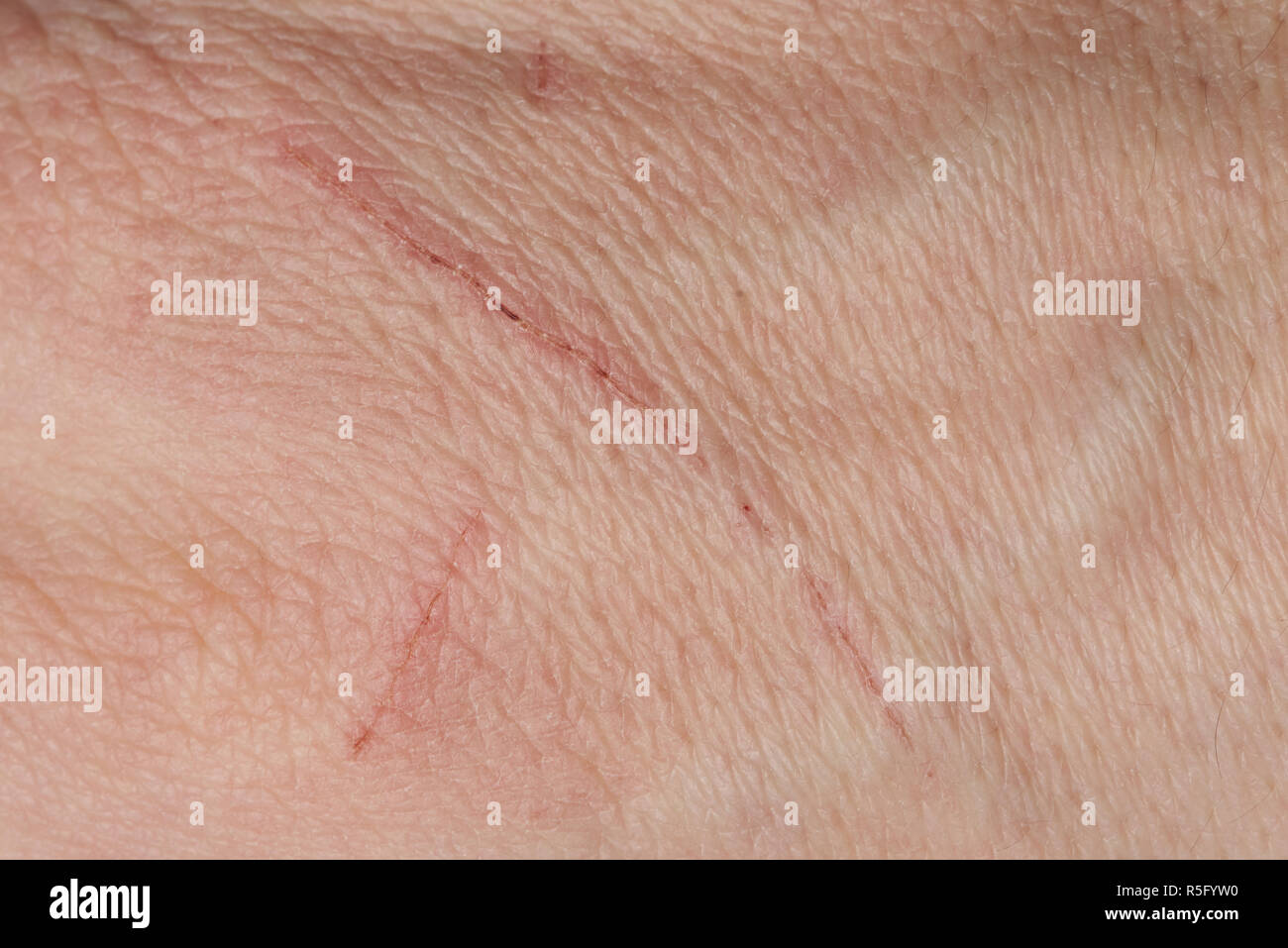 Claw scratch High Resolution Stock Photography and Images - Alamy