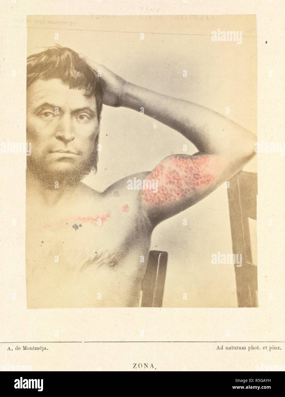 Zona b hi-res stock photography and images - Alamy