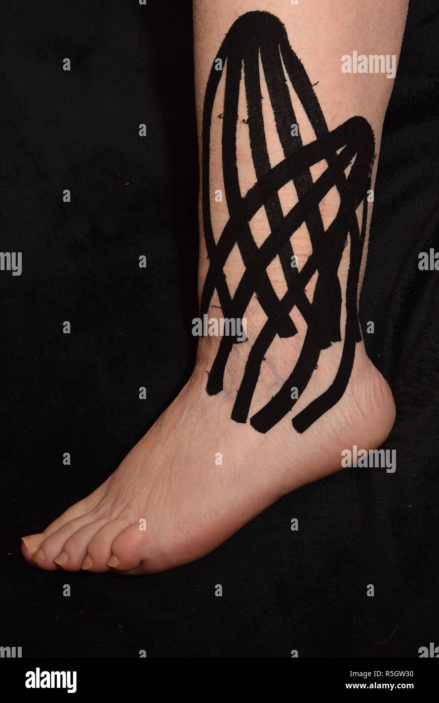 Tapeverband hi-res stock photography and images - Alamy