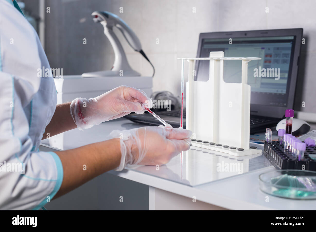 Medical clinic. Nurse works with blood samples. Filling up the pipette ...