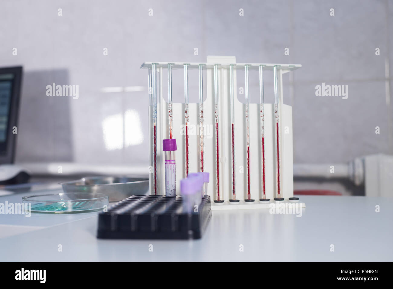 Medical clinic. A stand with pipettes filled with blood. Blood samples ...
