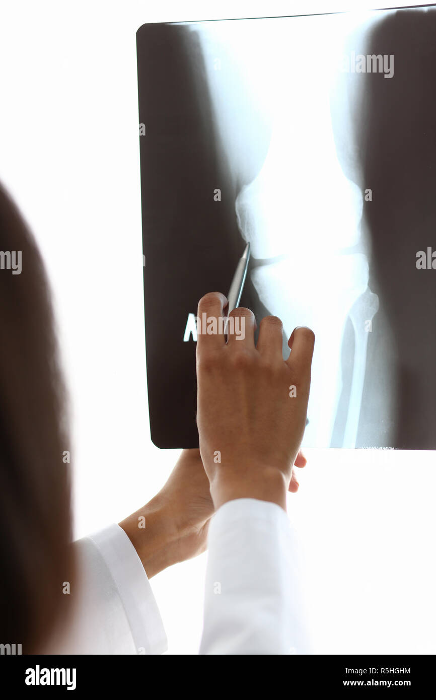 Female black doctor hold in arm and look Stock Photo - Alamy
