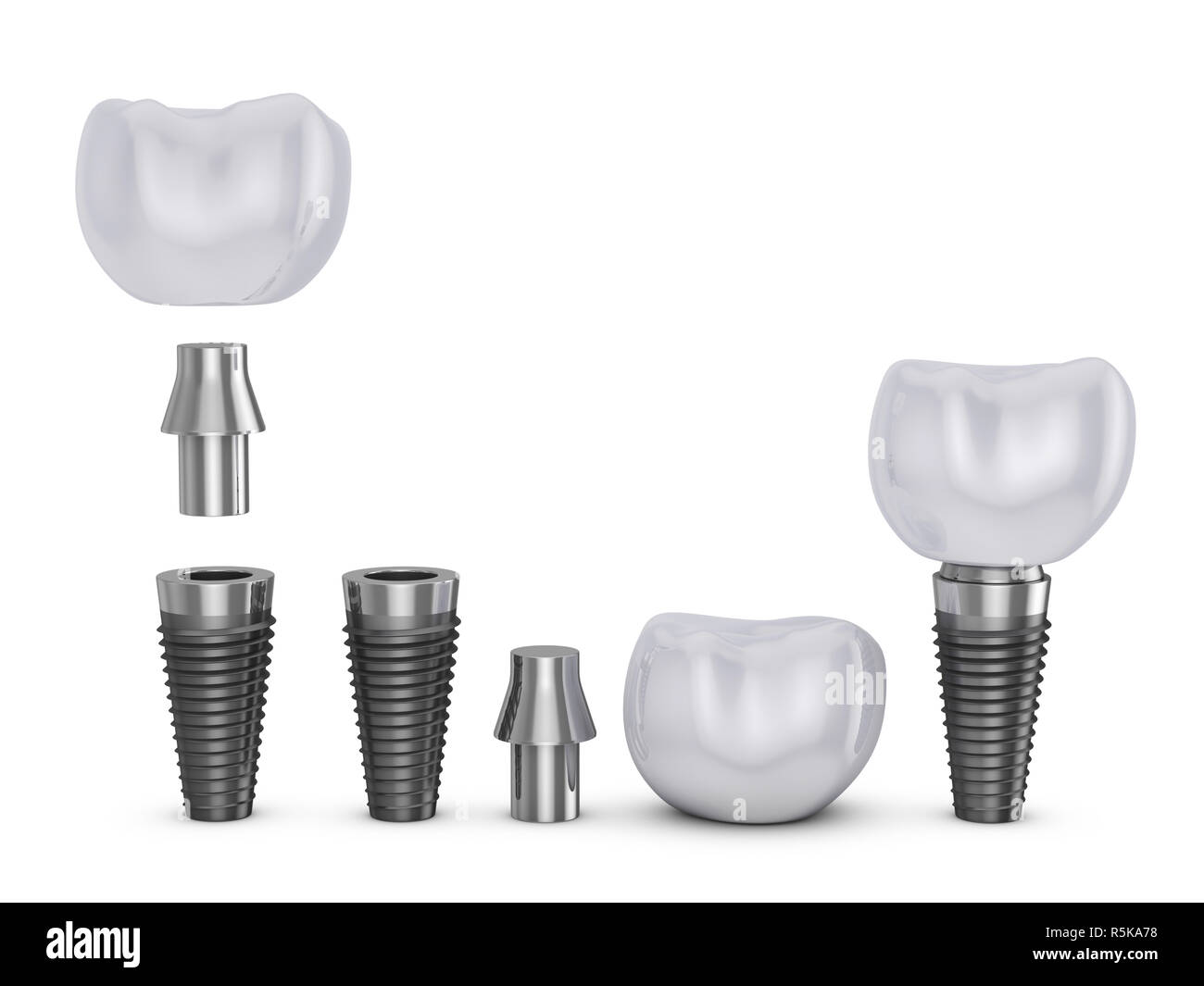 Orthodontic care plan hi-res stock photography and images - Alamy