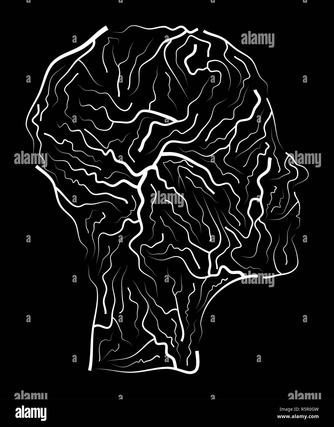Cerebral vascular hi-res stock photography and images - Alamy