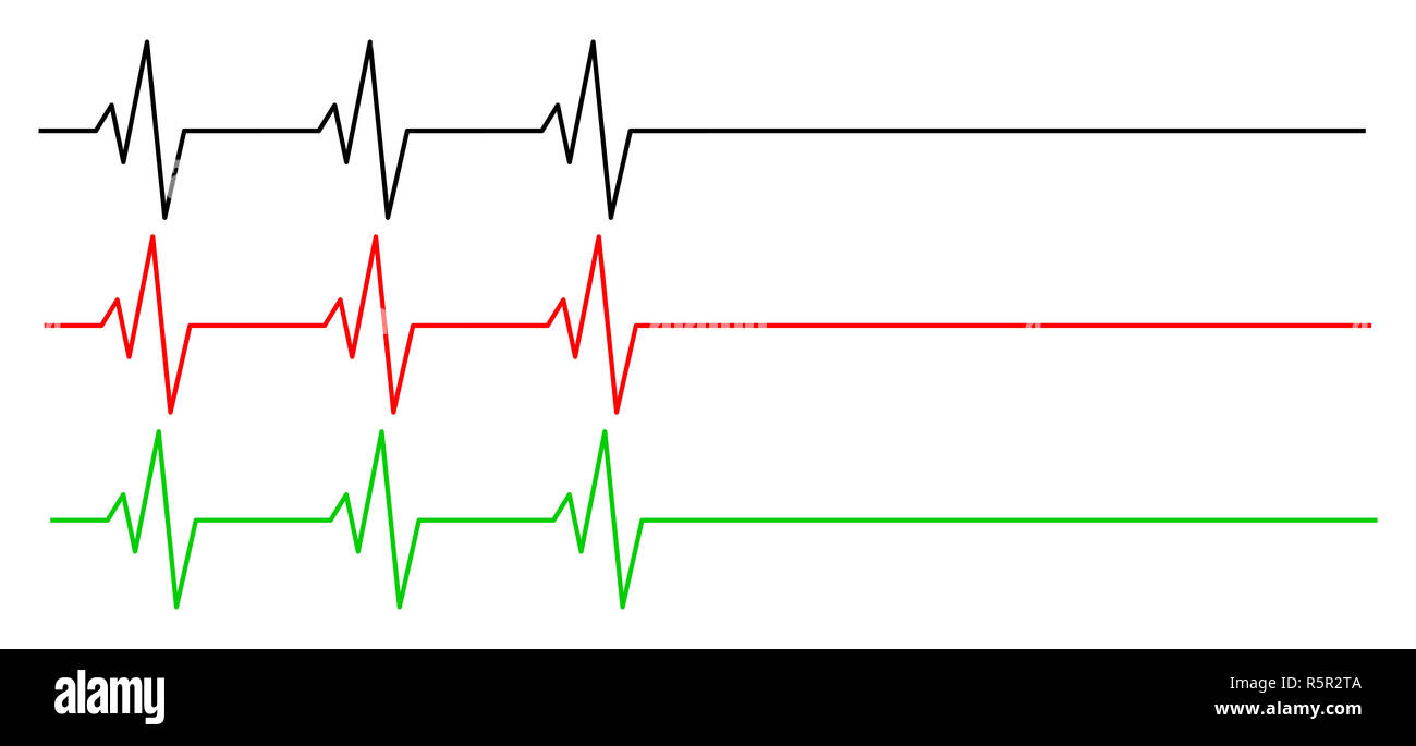 Vector Illustration Heart Rhythm