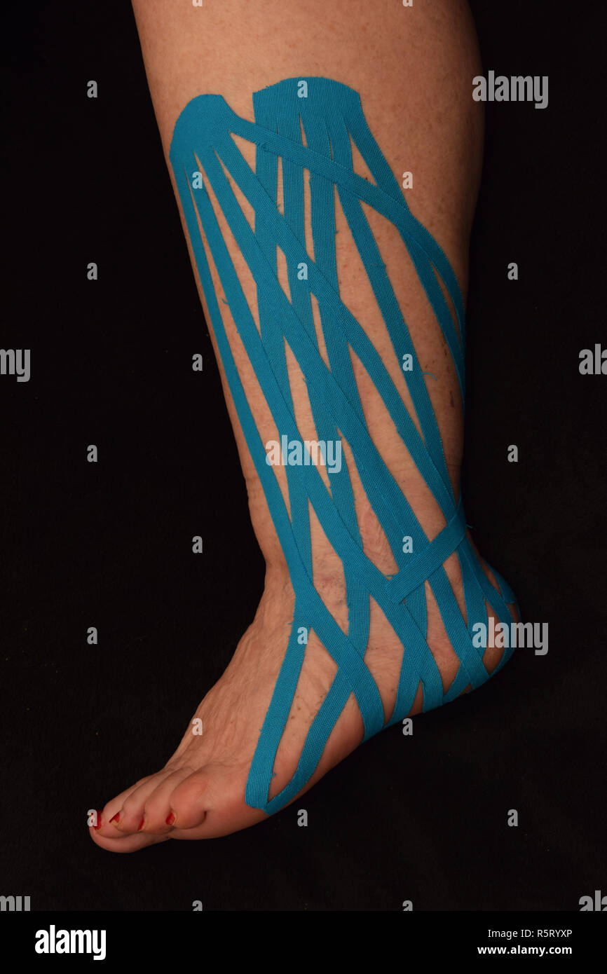 Bandaged Body Stock Photos & Bandaged Body Stock Images - Alamy