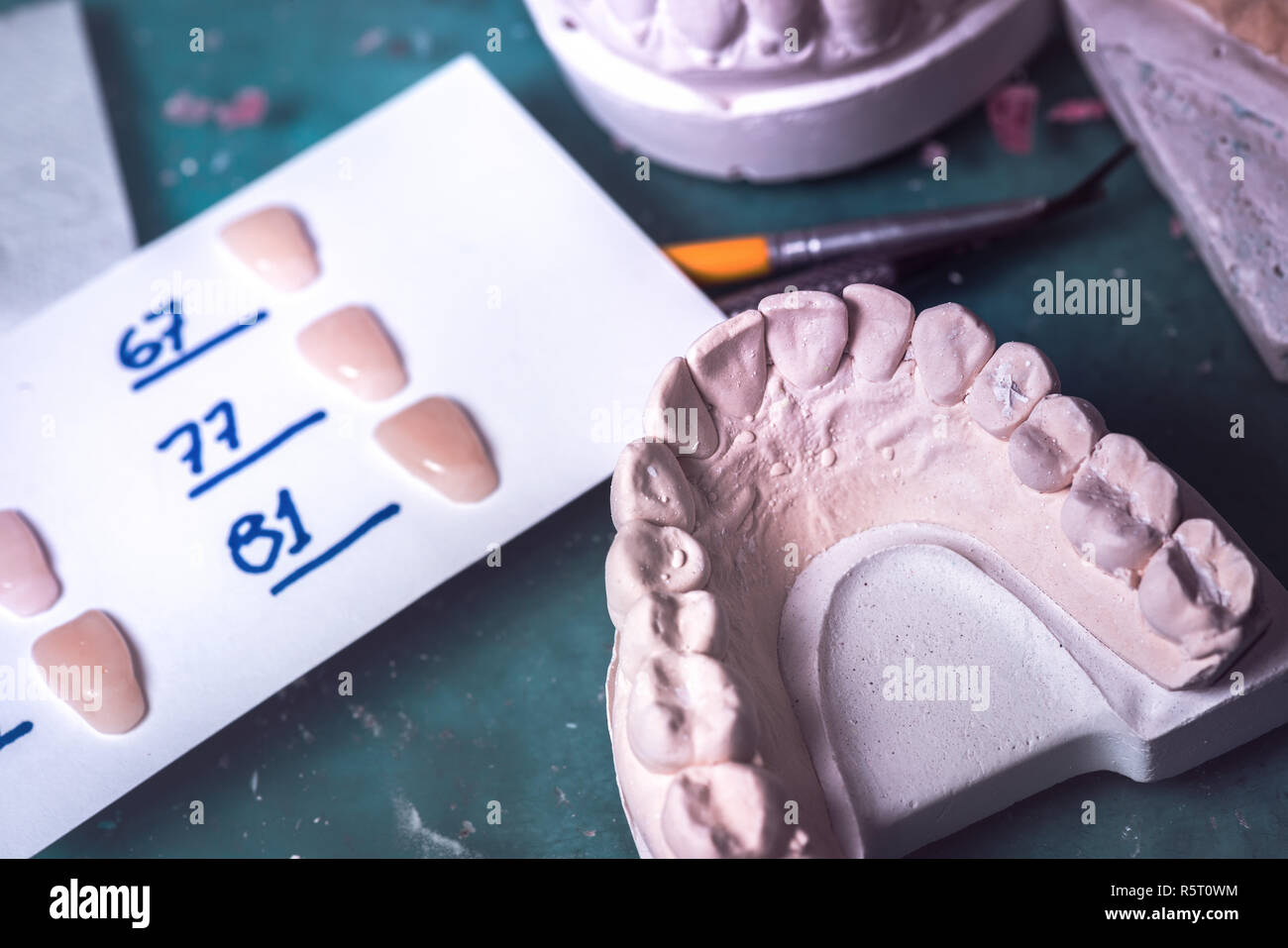 Dental Prosthesis Prosthetic Laboratory Stock Photo - Alamy