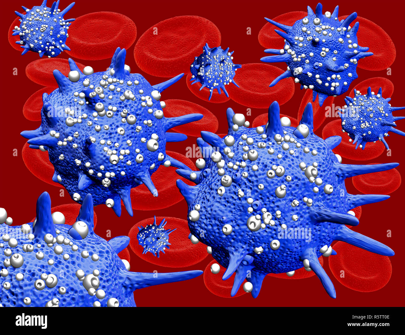 Illustrations Myelodysplastic syndromes, myeloma Stock Photo - Alamy