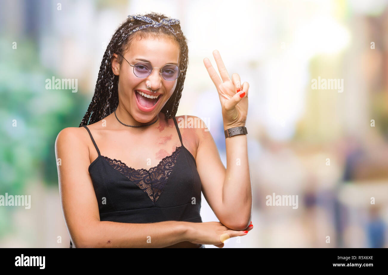 Young braided hair african american with birth mark wearing sunglasses ...