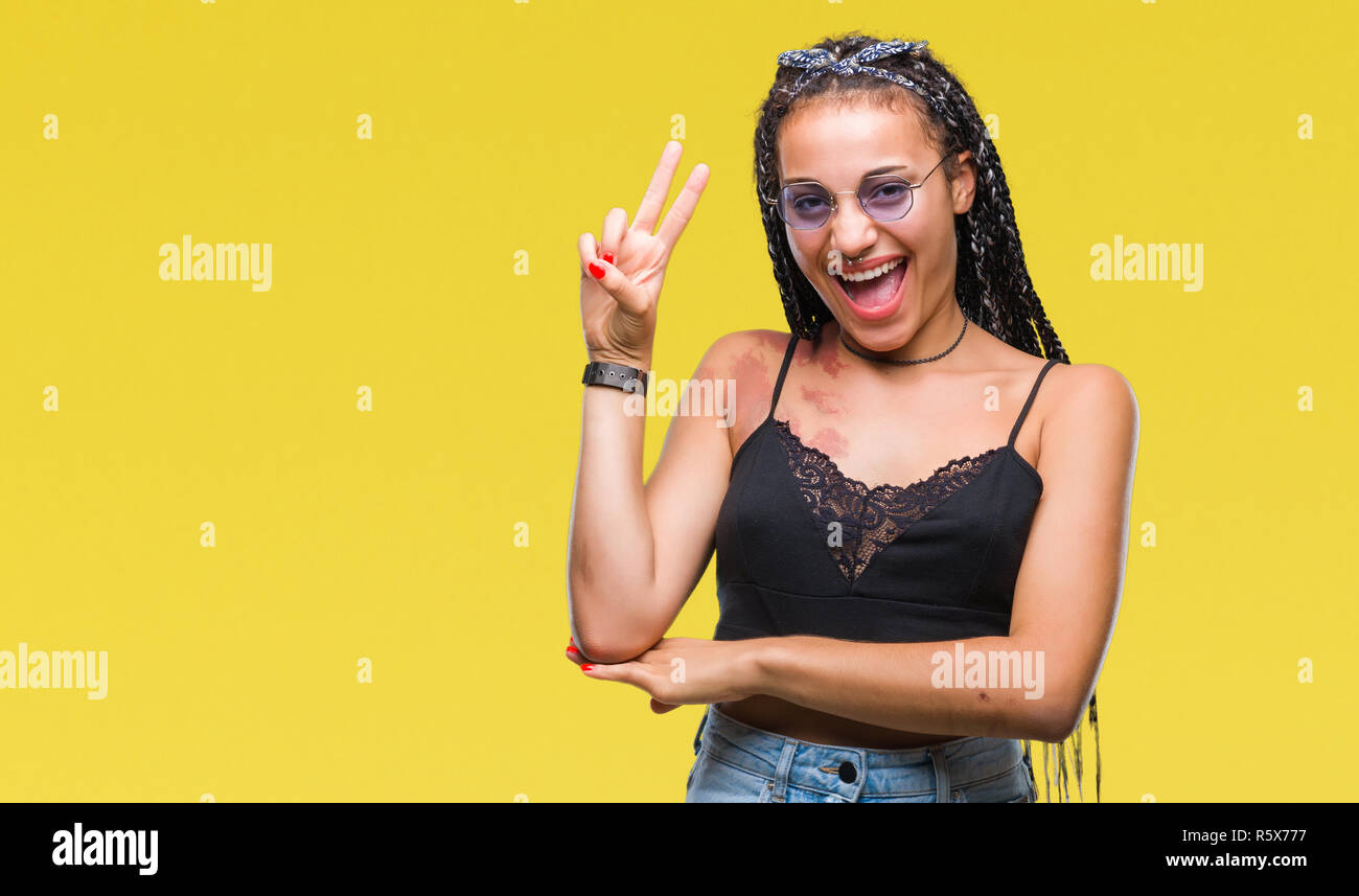 Young braided hair african american with birth mark wearing sunglasses ...